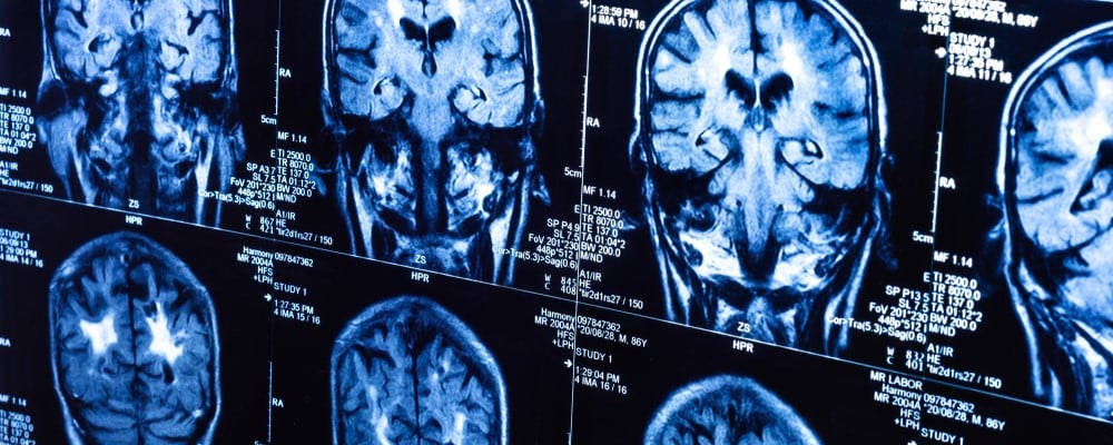 Helping Families in Cleveland, OH with Brain Trauma Resources